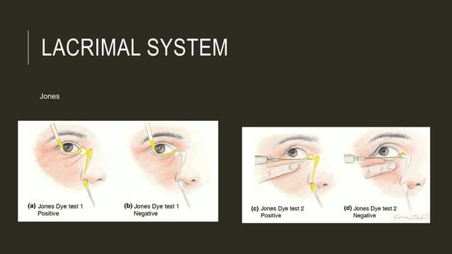 Eyelid, Lacrimal System, and Orbital Examination (1).pptx