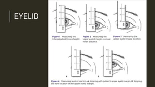 Eyelid, Lacrimal System, and Orbital Examination (1).pptx