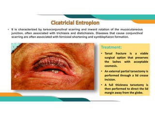 Eyelid malposition | PPTX