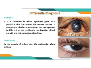 Eyelid malposition | PPTX