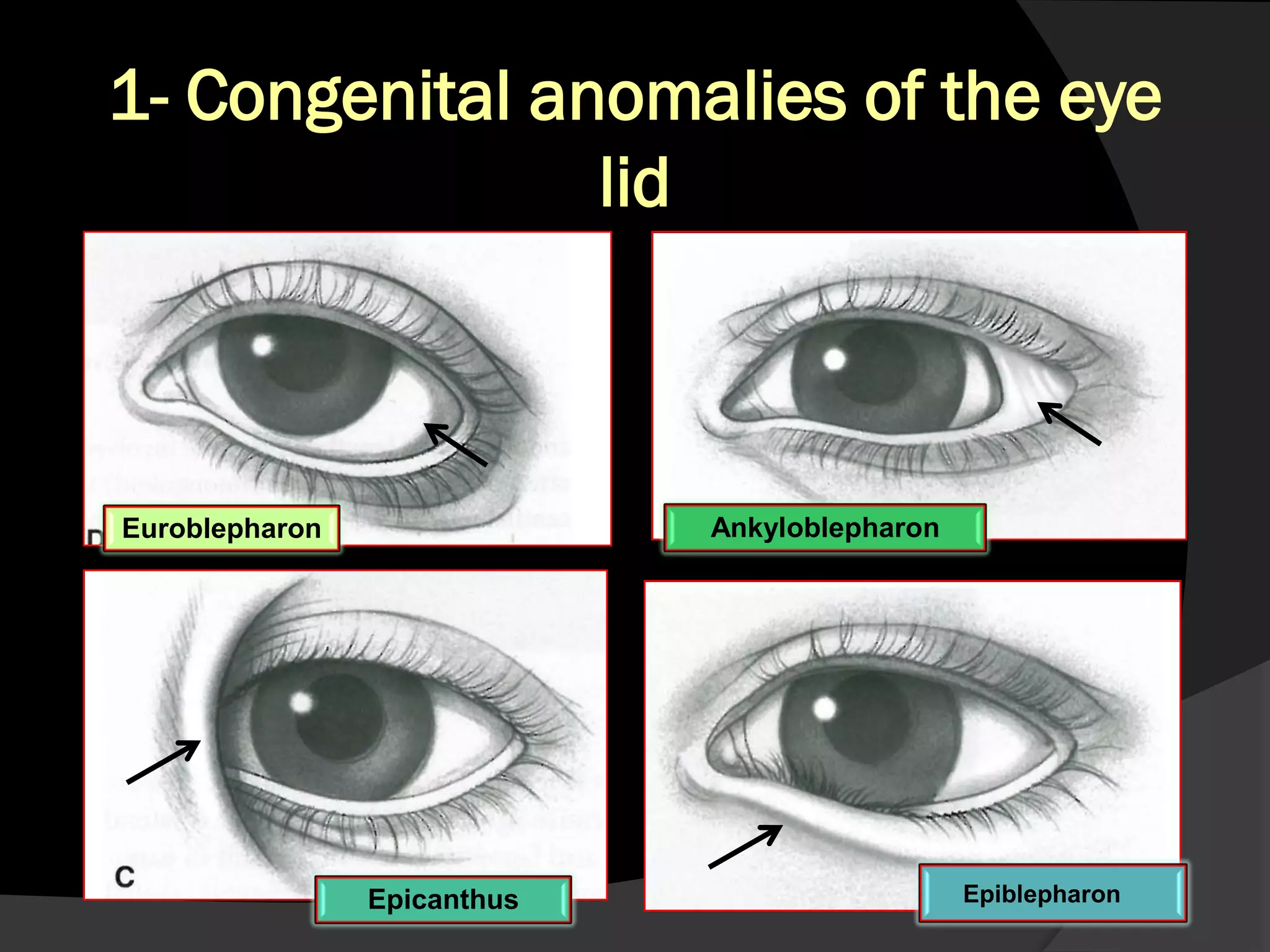 Eyelid pathology 1 | PDF