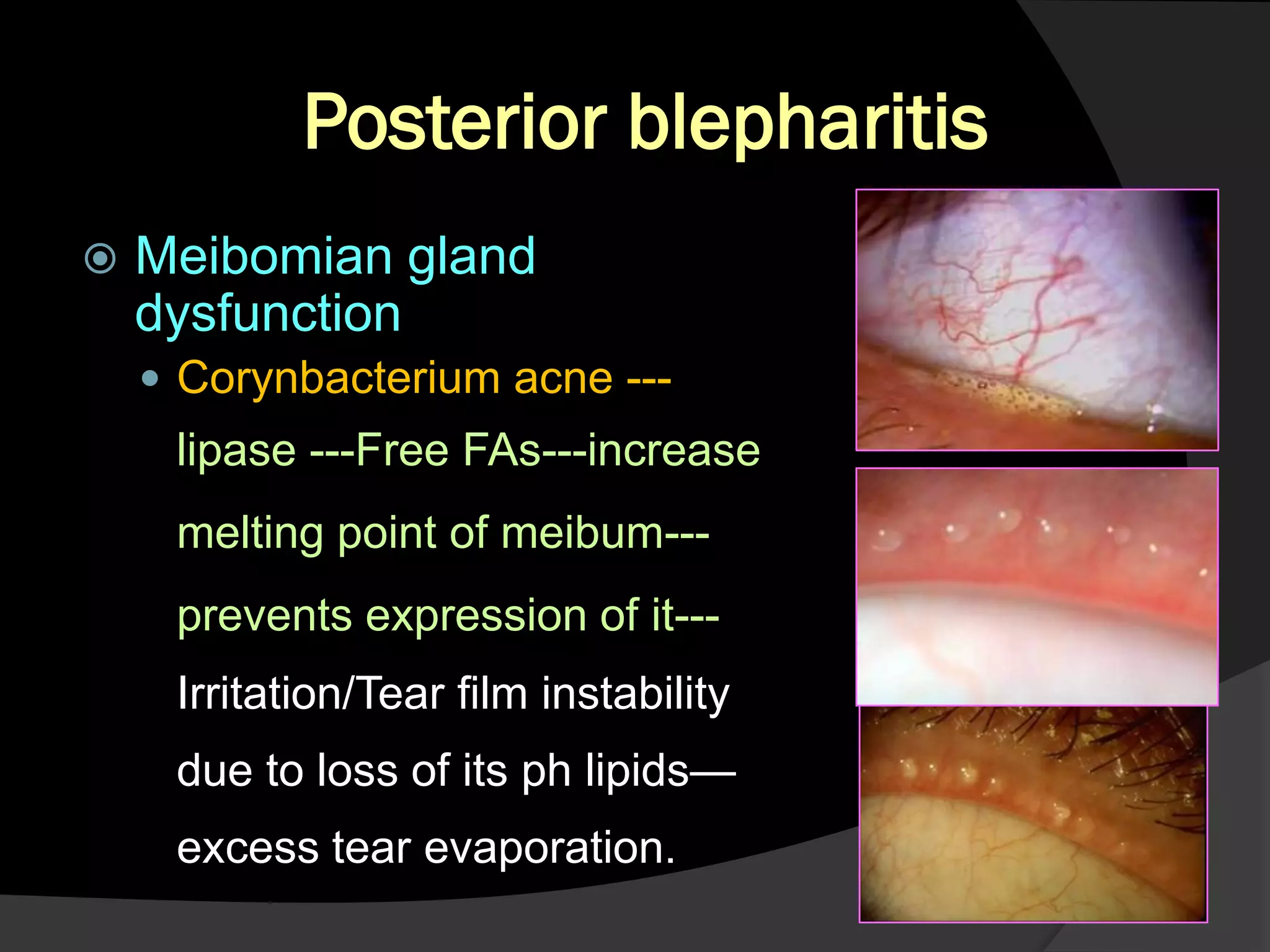 Eyelid pathology 1 | PDF