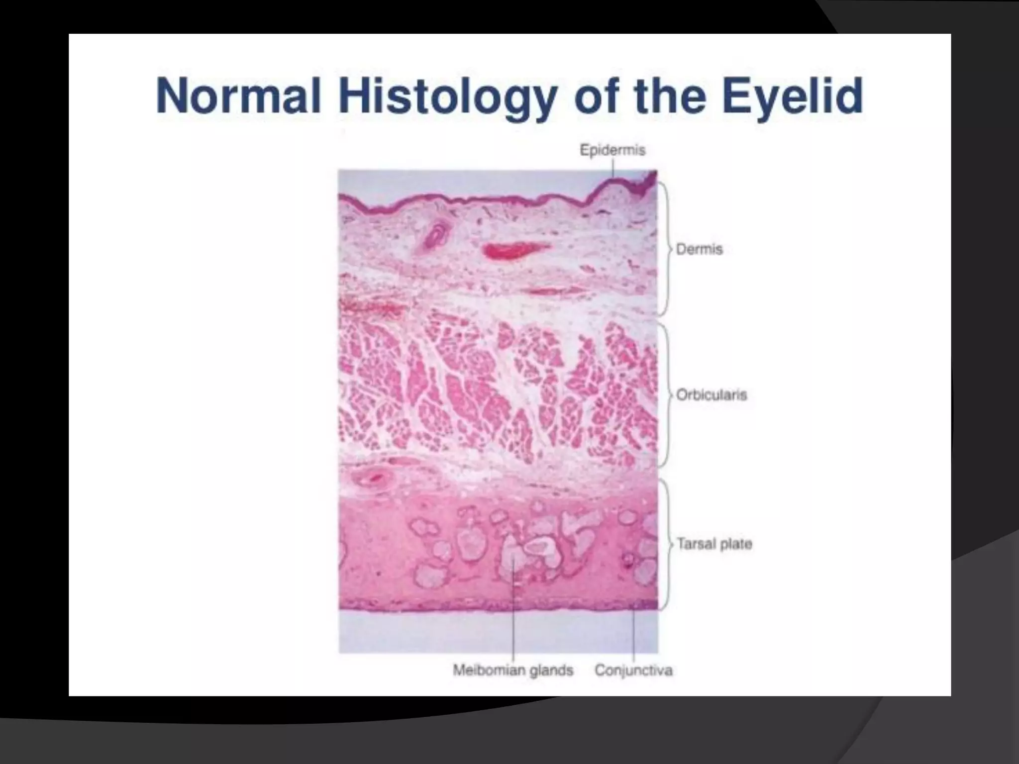 Eyelid pathology 1 | PDF