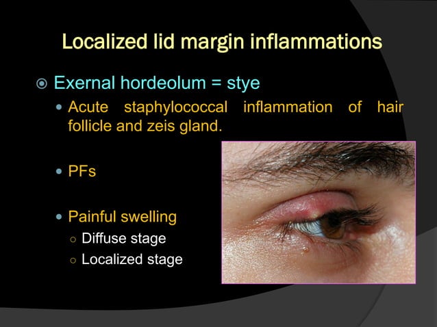 Eyelid pathology 1 | PDF | Skin and Dermatology | Diseases and Conditions