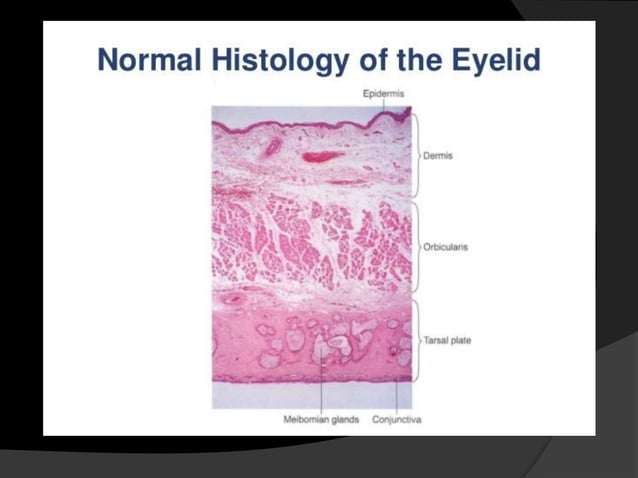 Eyelid pathology 1 | PDF | Skin and Dermatology | Diseases and Conditions