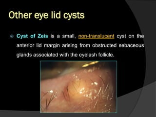 Eyelid pathology 1 | PDF