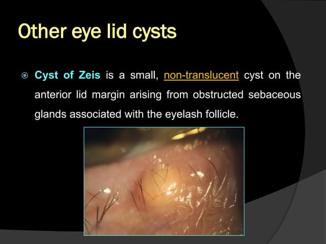 Eyelid pathology 1 | PDF | Skin and Dermatology | Diseases and Conditions