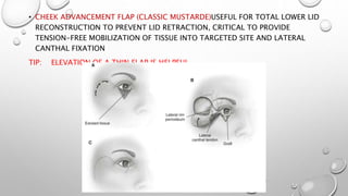 Eyelid reconstraction | PPTX
