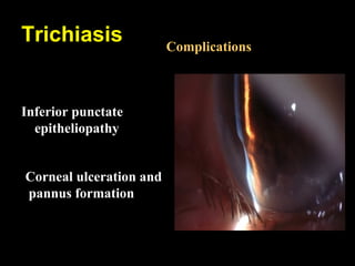 Eye lids disorders of lashes | PPT