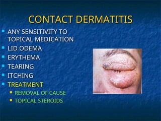 EYELIDS DISORDERS for pg studets powerpoint | PPT