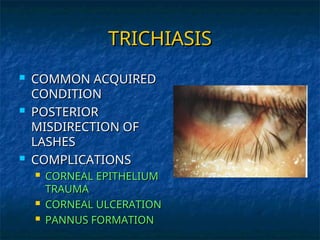 EYELIDS DISORDERS for pg studets powerpoint | PPT