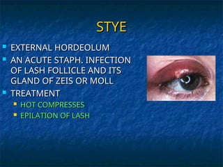 EYELIDS DISORDERS for pg studets powerpoint | PPT