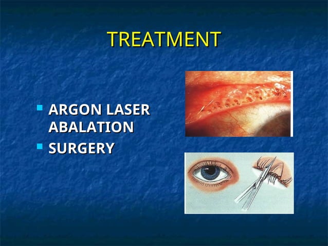 EYELIDS DISORDERS for pg studets powerpoint | PPT
