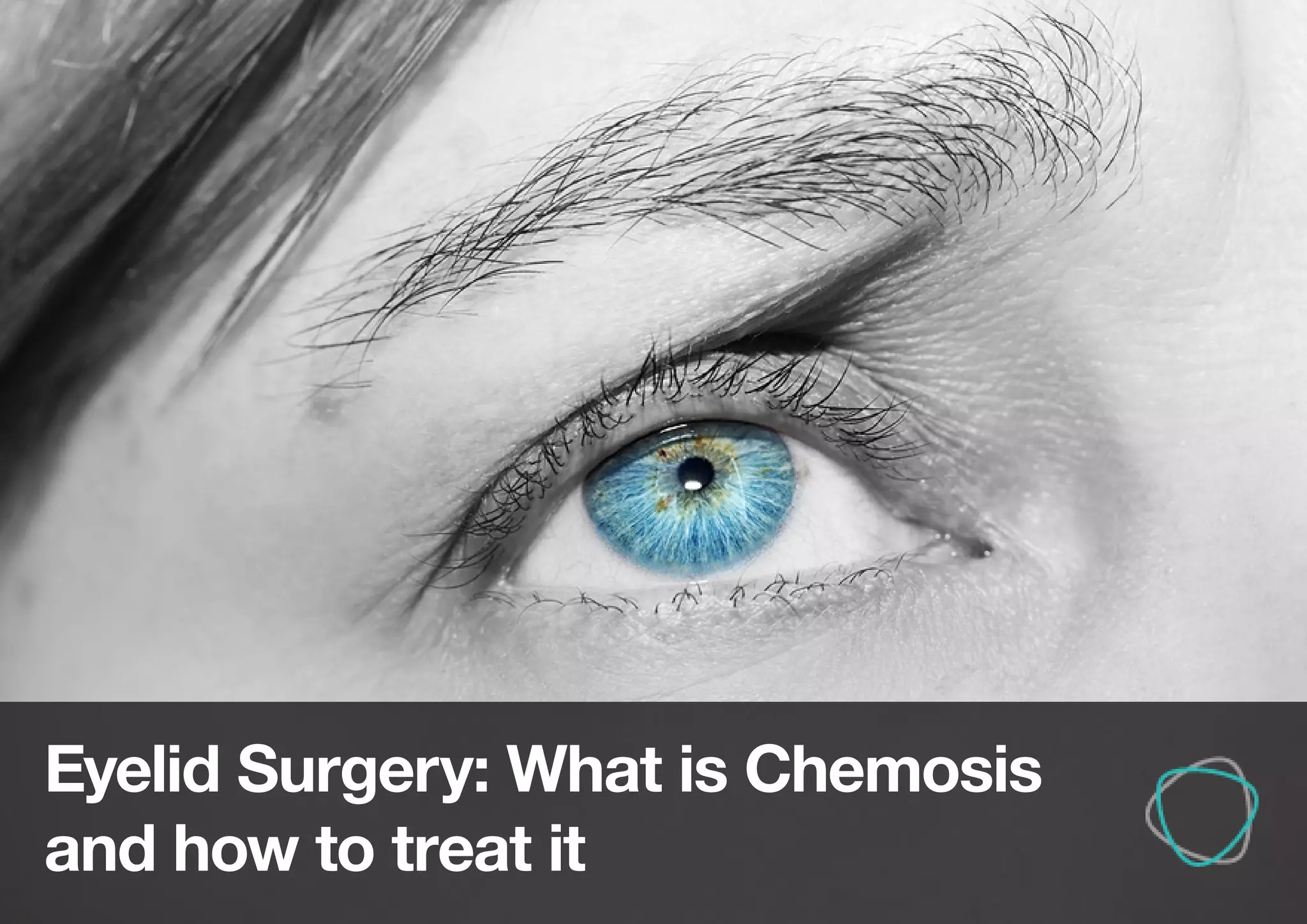 Eyelid surgery: What is chemosis and how to treat it | PDF