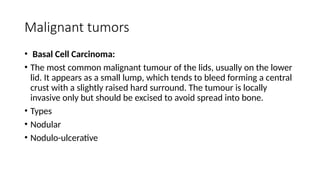 eye lid tumors.pptx . . . . . . . . | PPT