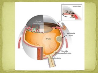 Eye lymphatics | PPTX