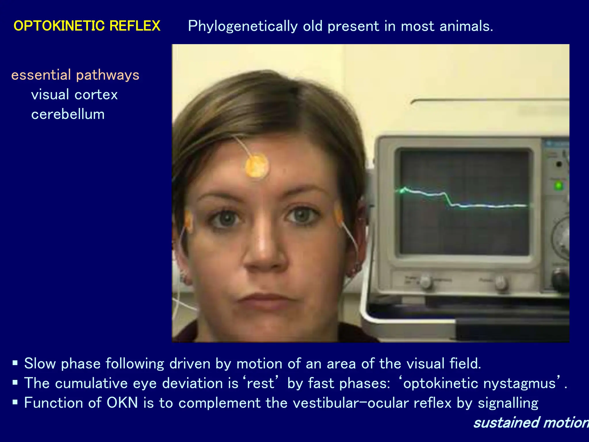 eye movements saccades, pursuit, optokinetic.ppt