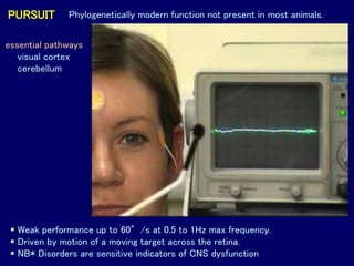 eye movements saccades, pursuit, optokinetic.ppt