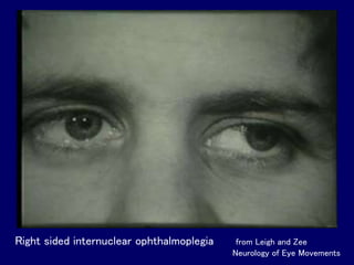 eye movements saccades, pursuit, optokinetic.ppt