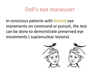 Eye movements examination | PPTX | Eye and Vision Conditions | Diseases ...