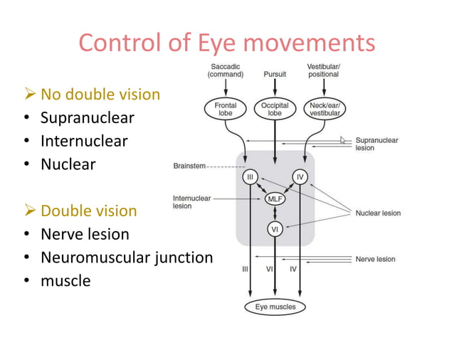 Eye movements examination | PPTX | Eye and Vision Conditions | Diseases ...