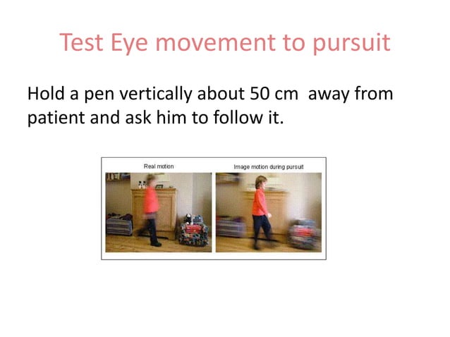 Eye movements examination | PPTX | Eye and Vision Conditions | Diseases ...