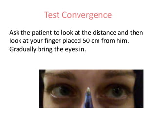 Eye movements examination | PPTX | Eye and Vision Conditions | Diseases ...