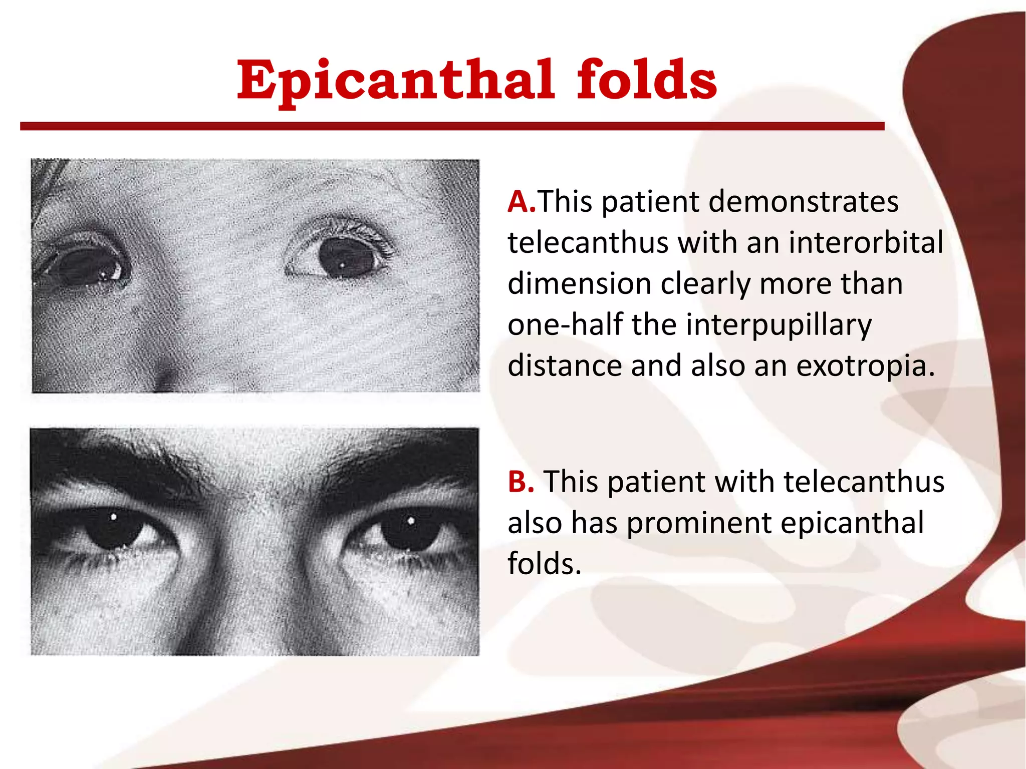 Eye Muscles Anatomy | PPTX