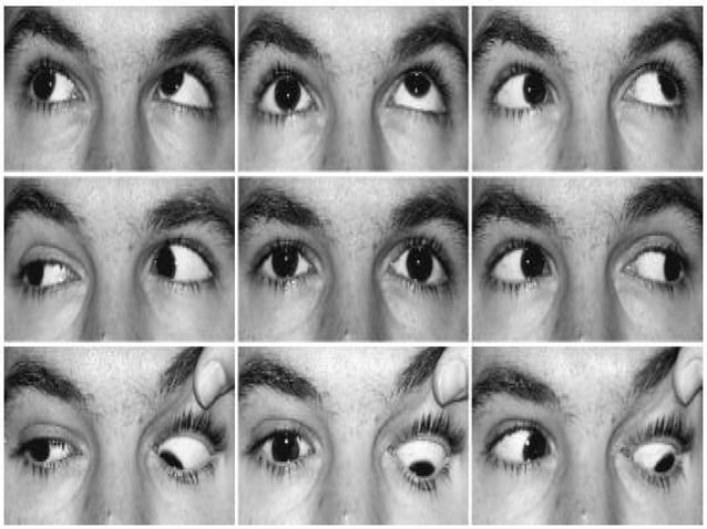 Eye muscles and ocular movements, laws of ocular motility | PPT | Eye ...