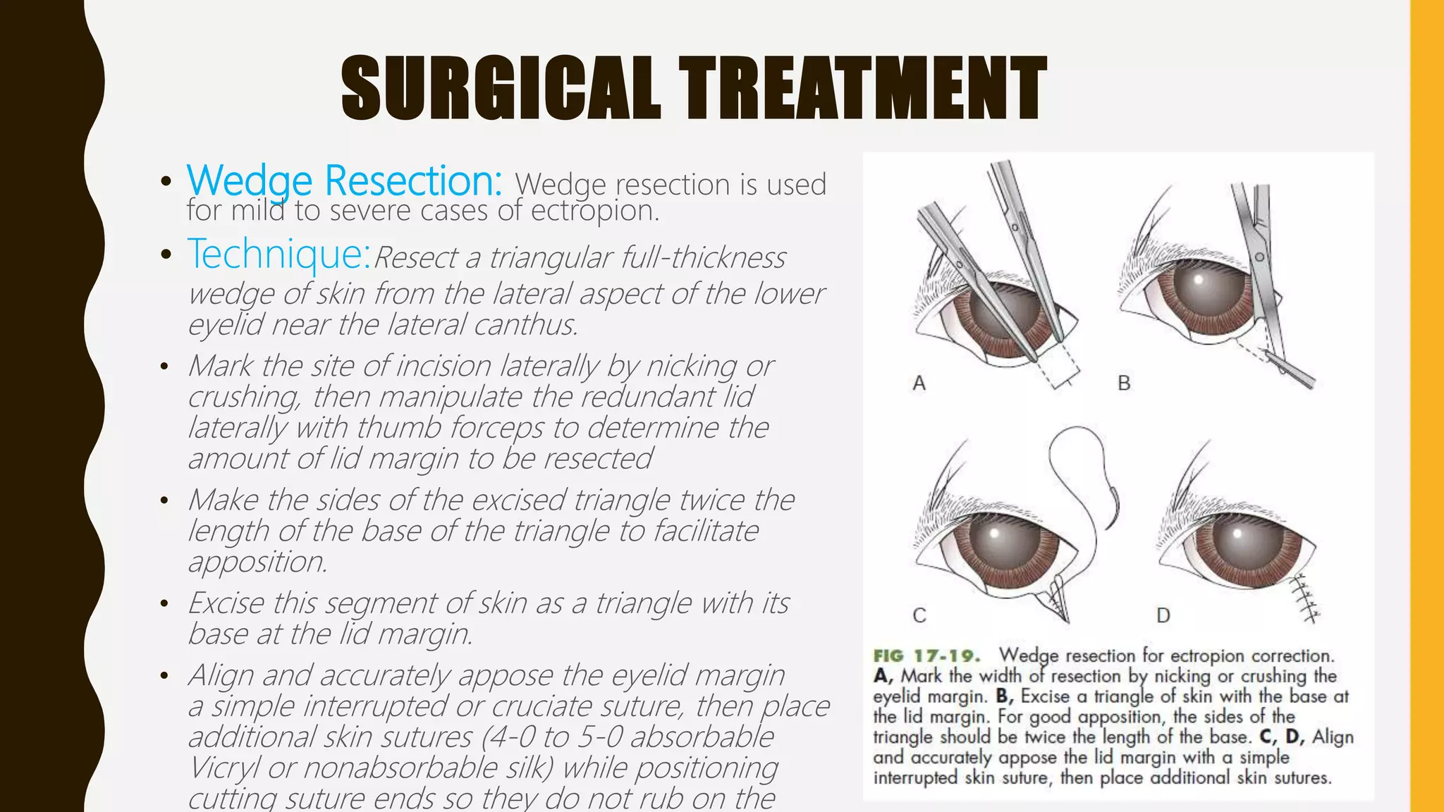 OCULAR EMERGENCIES | PPTX