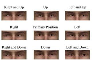 Eye and its disorders in anatomy and physiology | PPTX