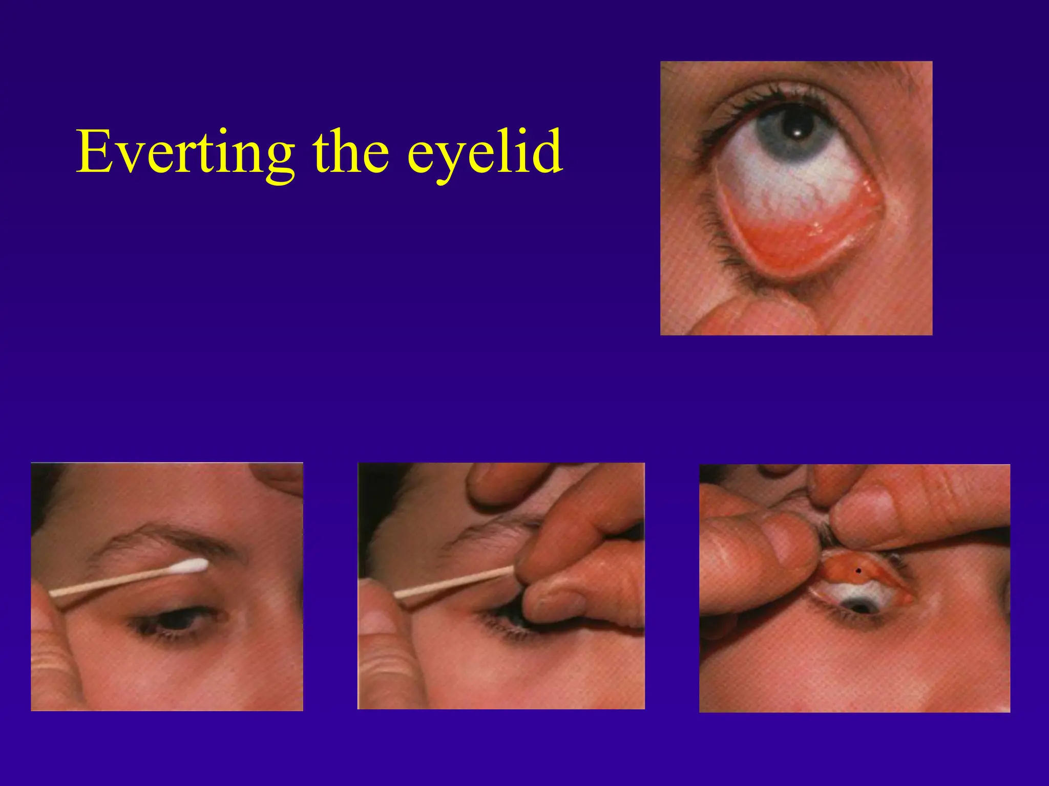 Eye Ophthalmologic Emergencies.......... | PPT