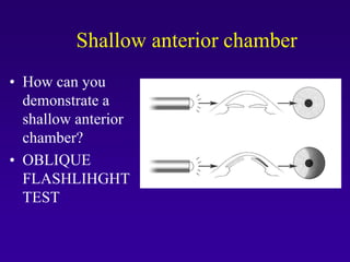 Eye Ophthalmologic Emergencies.......... | PPT