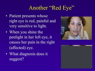 Eye Ophthalmologic Emergencies.......... | PPT