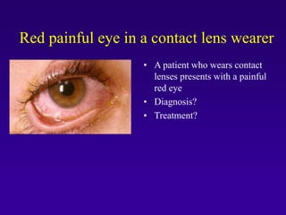 Eye Ophthalmologic Emergencies.......... | PPT
