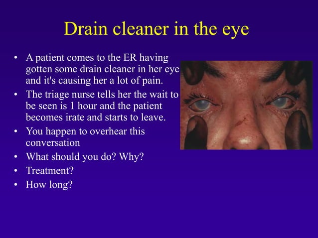 Eye Ophthalmologic Emergencies.......... | PPT | Eye and Vision ...