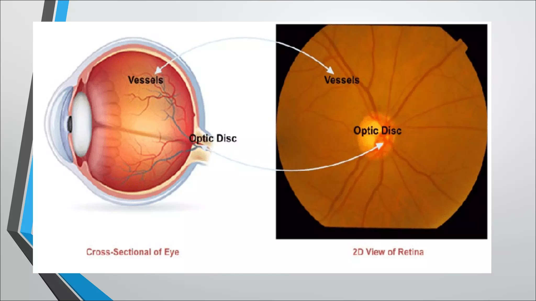 Eye optic nerve and visal pathway.pdf