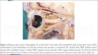 Eye optic nerve and visal pathway.pdf