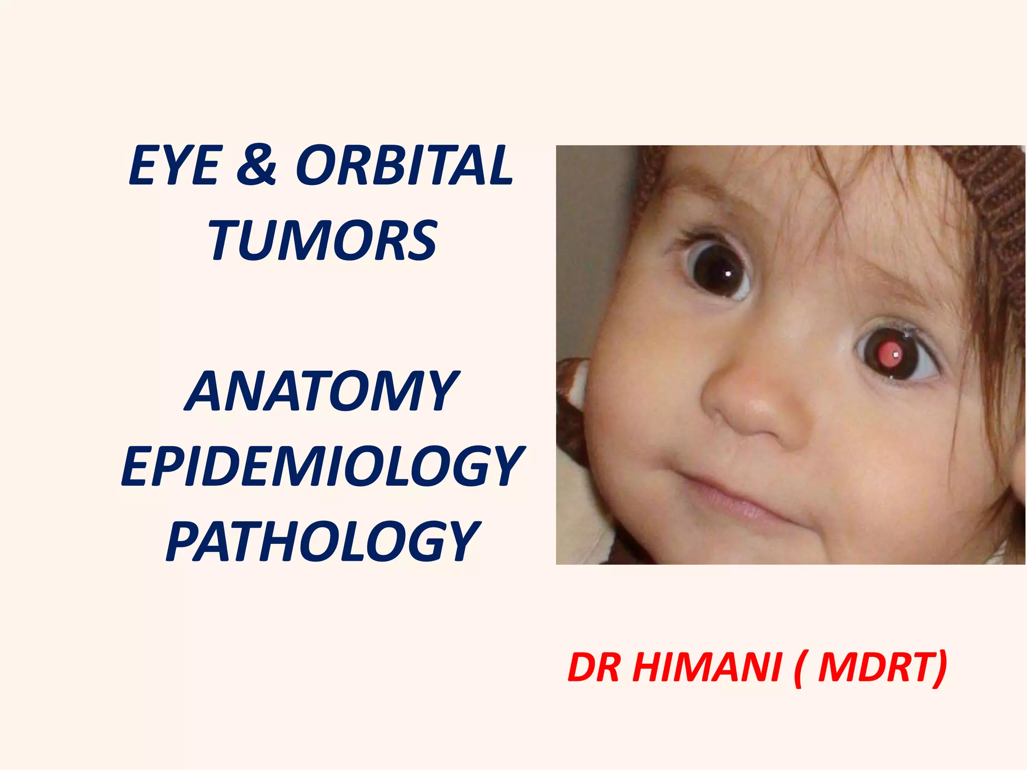 Eye & orbit tumors anatomy, epidemiology, pathology by himani | PPTX