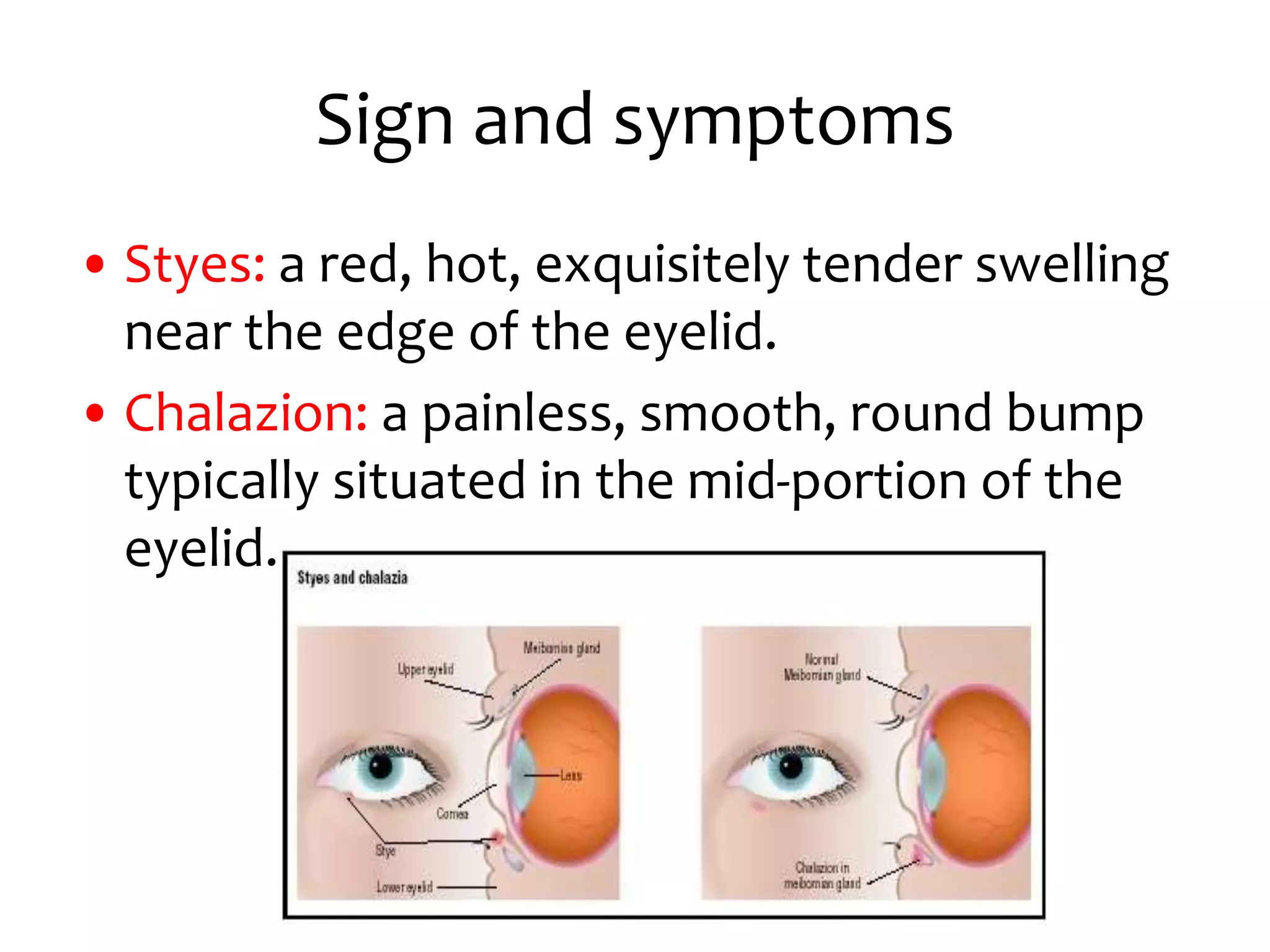 eye pathologies.ppt