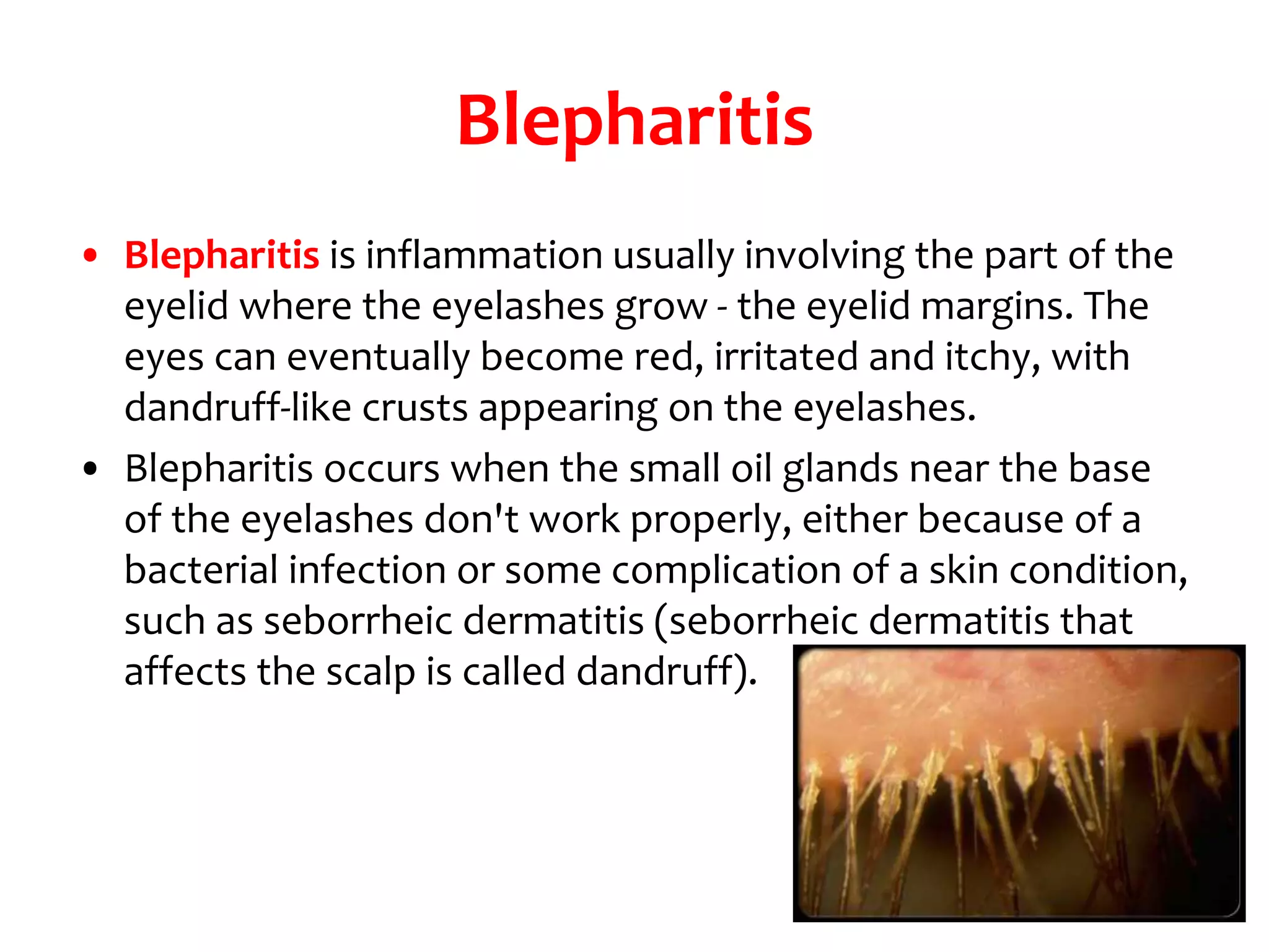 eye pathologies.ppt
