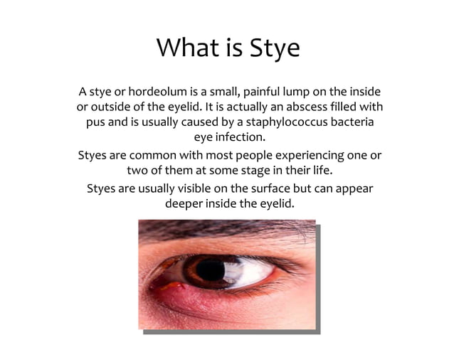 eye pathologies.ppt