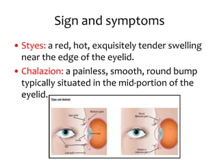 eye pathologies.ppt