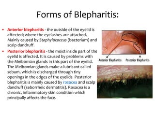 eye pathologies.ppt