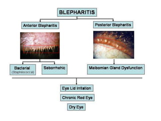eye pathologies.ppt