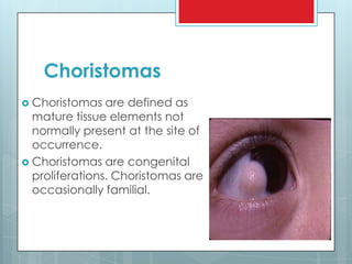 Eye patology | PPT