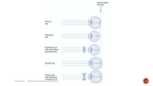 Eye physiology from guyton and halls physiology Part 1 | PPTX | Eye and ...