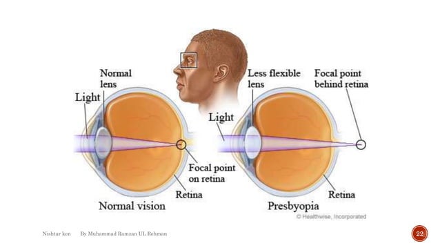 Eye physiology from guyton and halls physiology Part 1 | PPTX | Eye and ...