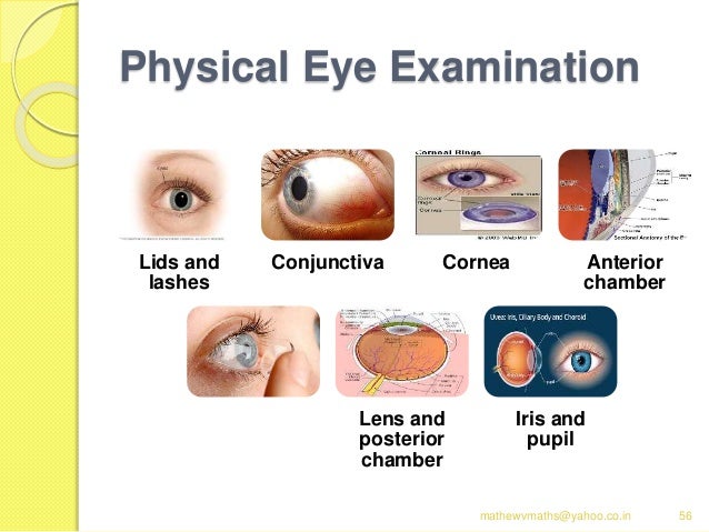 Eye assessment -ppt