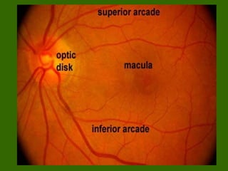 Hypertensive Retinopathy | PPT